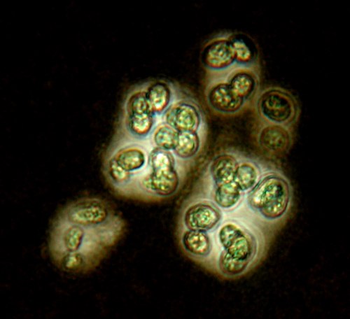 Gloeocapsa Slide Labeled